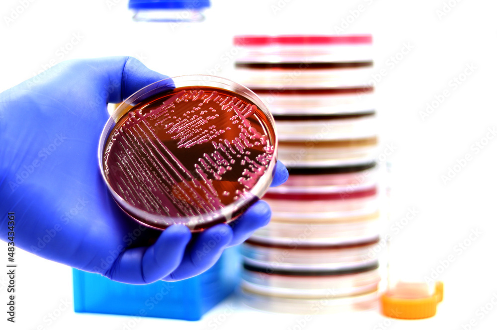 Hand of a doctor or researcher holding a culture of the bacterium ...