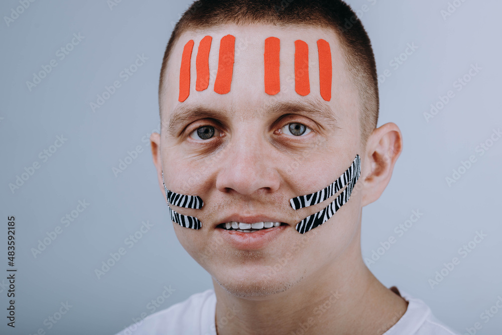 Close-up portrait of a guy looking at the camera with red patches on ...