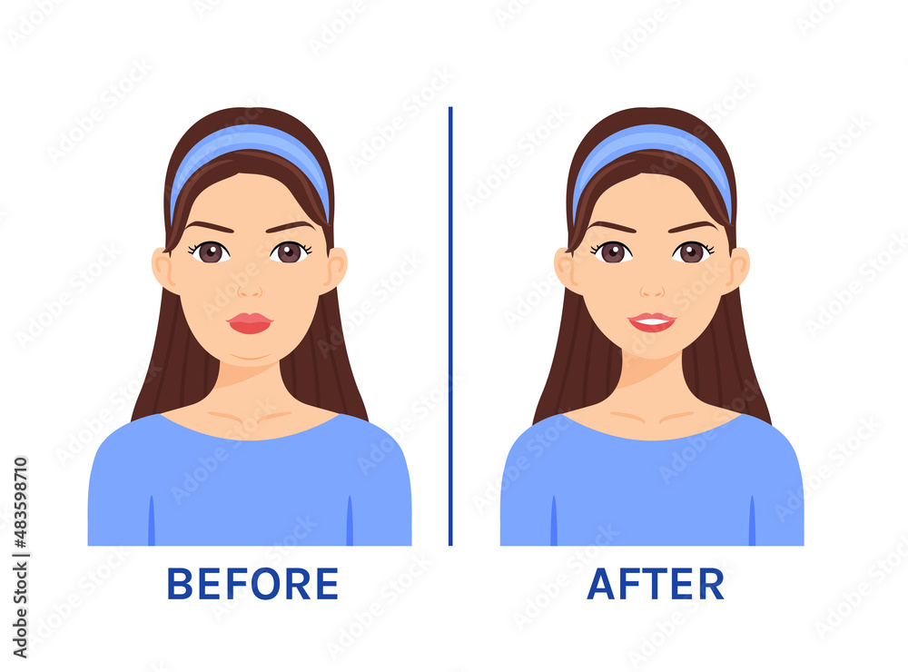 Beautiful Woman with Fat Face. Overweight and Double Chin. Treatment ...