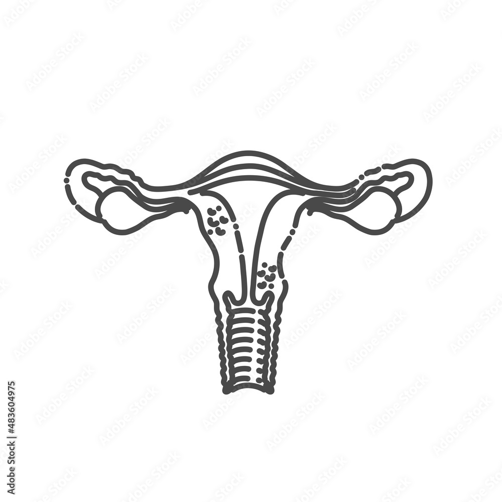 Uterus illustration. Human internal organs. Vector illustration Stock ...