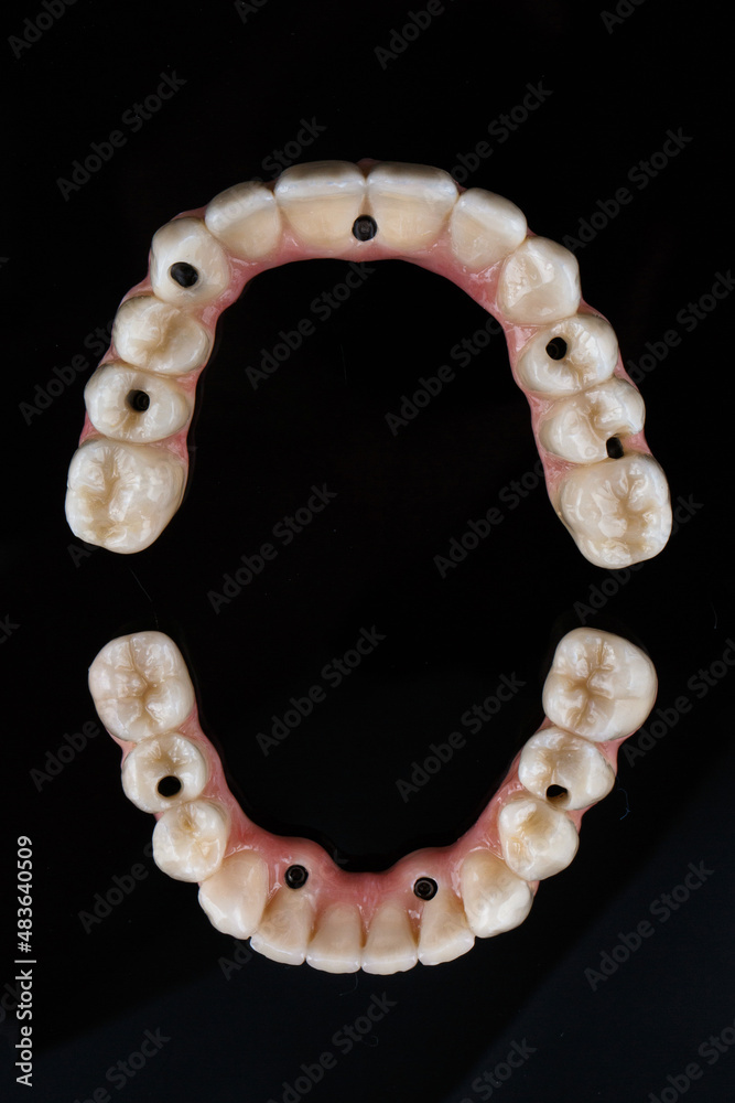 beautiful morphology and anatomy of teeth on ceramic prostheses, top ...