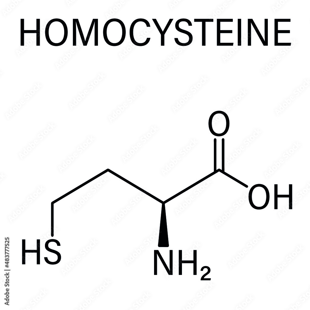 Homocysteine or Hcy biomarker molecule. Increased levels indicate ... Homocysteine or Hcy biomarker molecule. Increased levels indicate ...