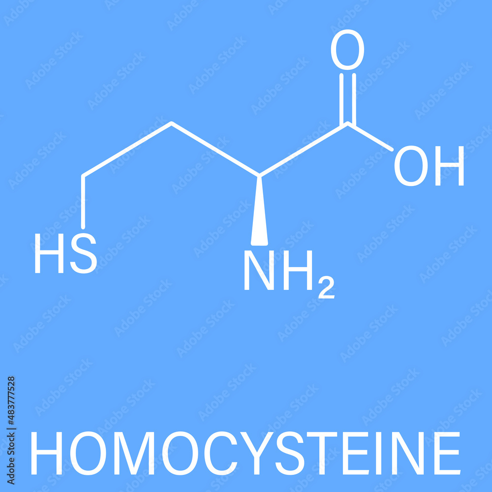 Homocysteine or Hcy biomarker molecule. Increased levels indicate ... Homocysteine or Hcy biomarker molecule. Increased levels indicate ...