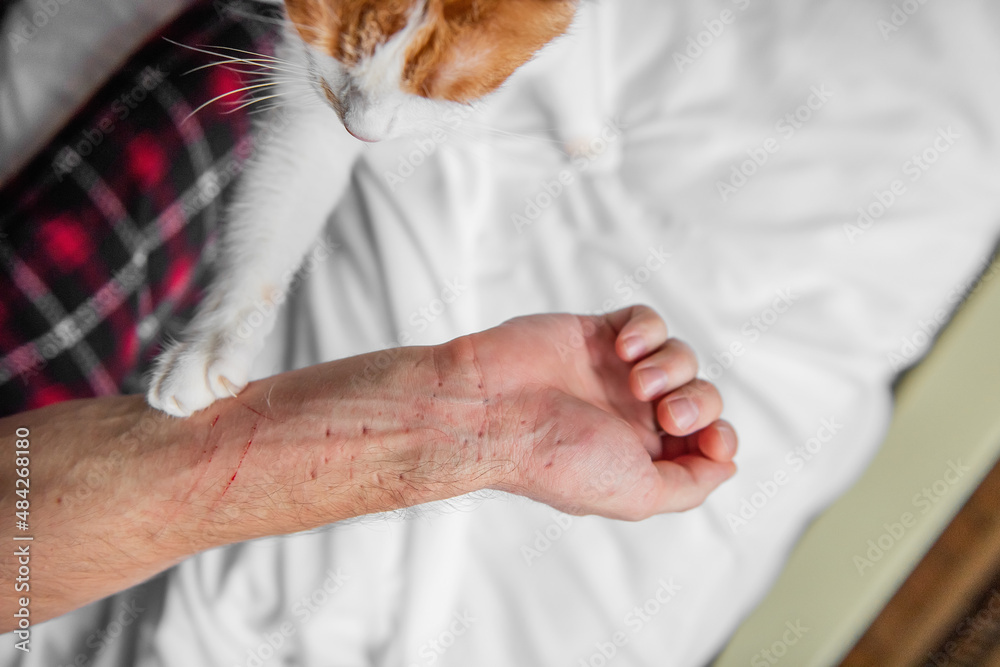 Rabid white-red cat furiously scratched, bit through the mans hand ...