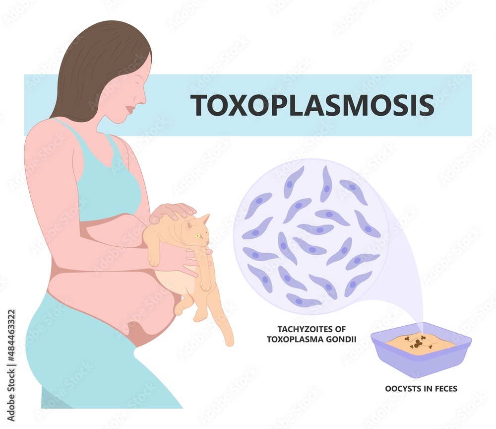 Toxoplasmosis cyst Fecal life cycle cat retina eye hiv aids mother ...