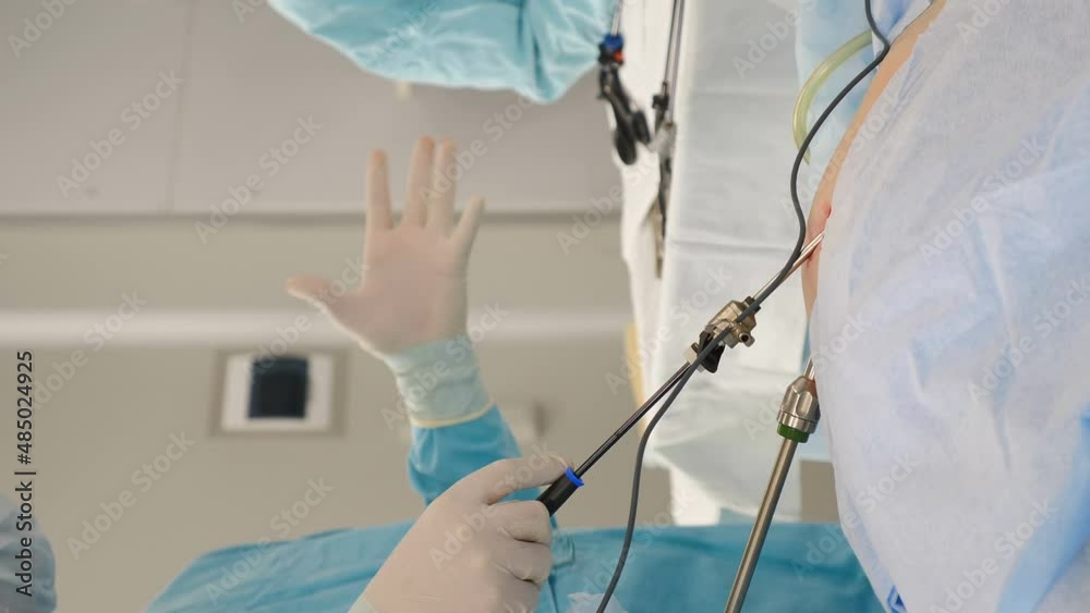Surgical laparoscopic operation in clinic. Nurse in operating room ...
