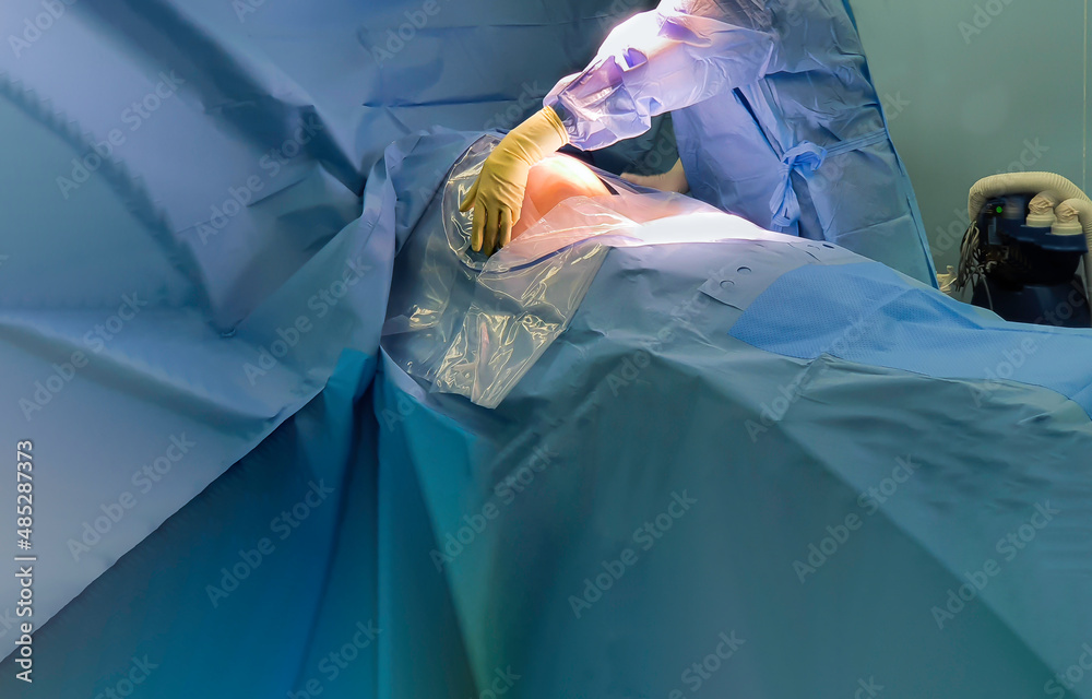 Caesarean section, Scrub nurse preparing the abdomen, cleaning and ...