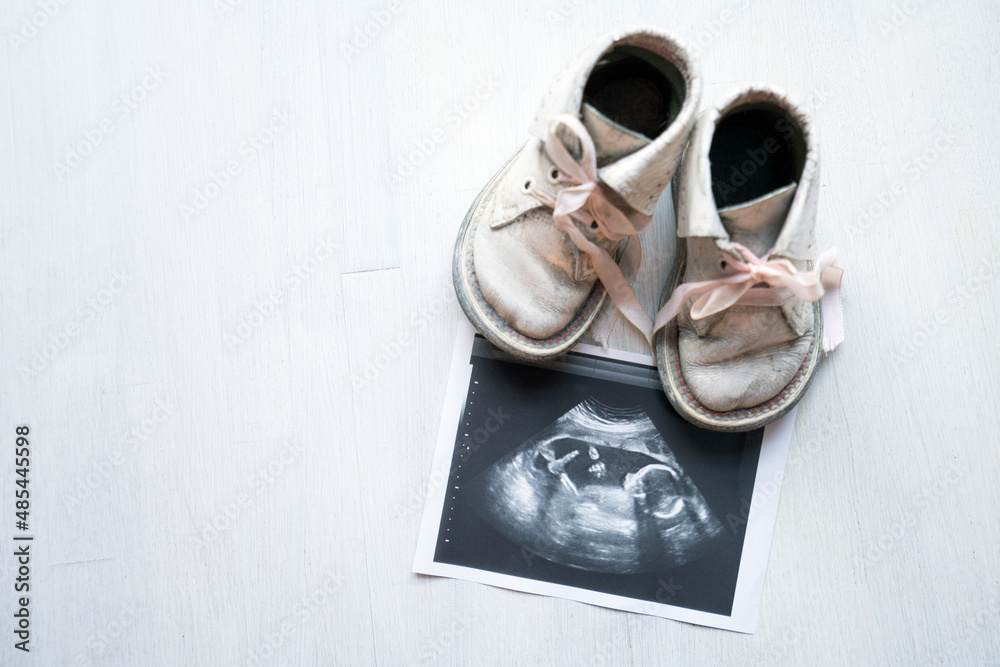 Pink baby girl shoes standing next to ultrasound image isolated on ...