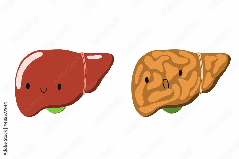 Sick and healthy liver character. Liver disease. Cirrhosis, hepatitis ...