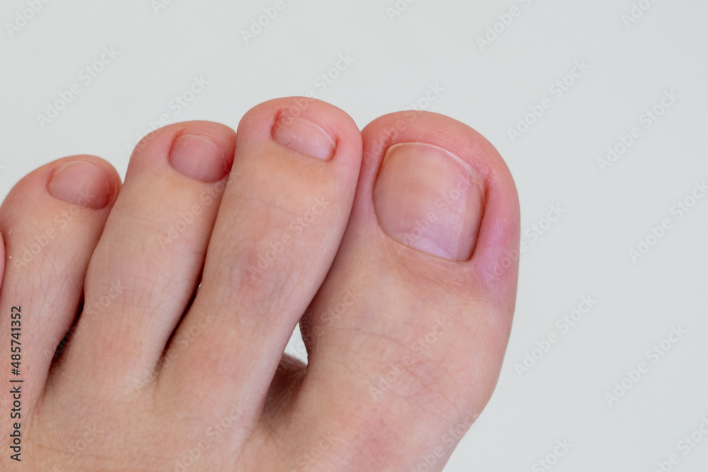 Healthy Toes