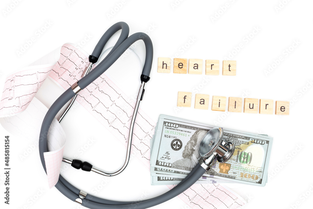 Heart failure. Flatlay arrangement. Stethoscope with electrocardiogram ...