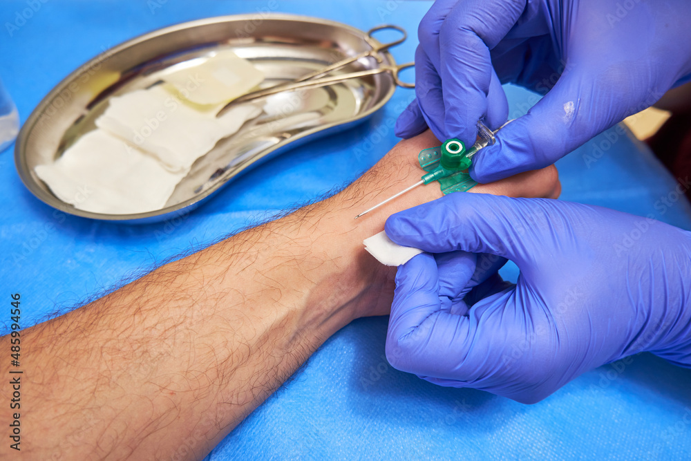 Preparation for vein catheterization close up. Intravenous catheter in ...