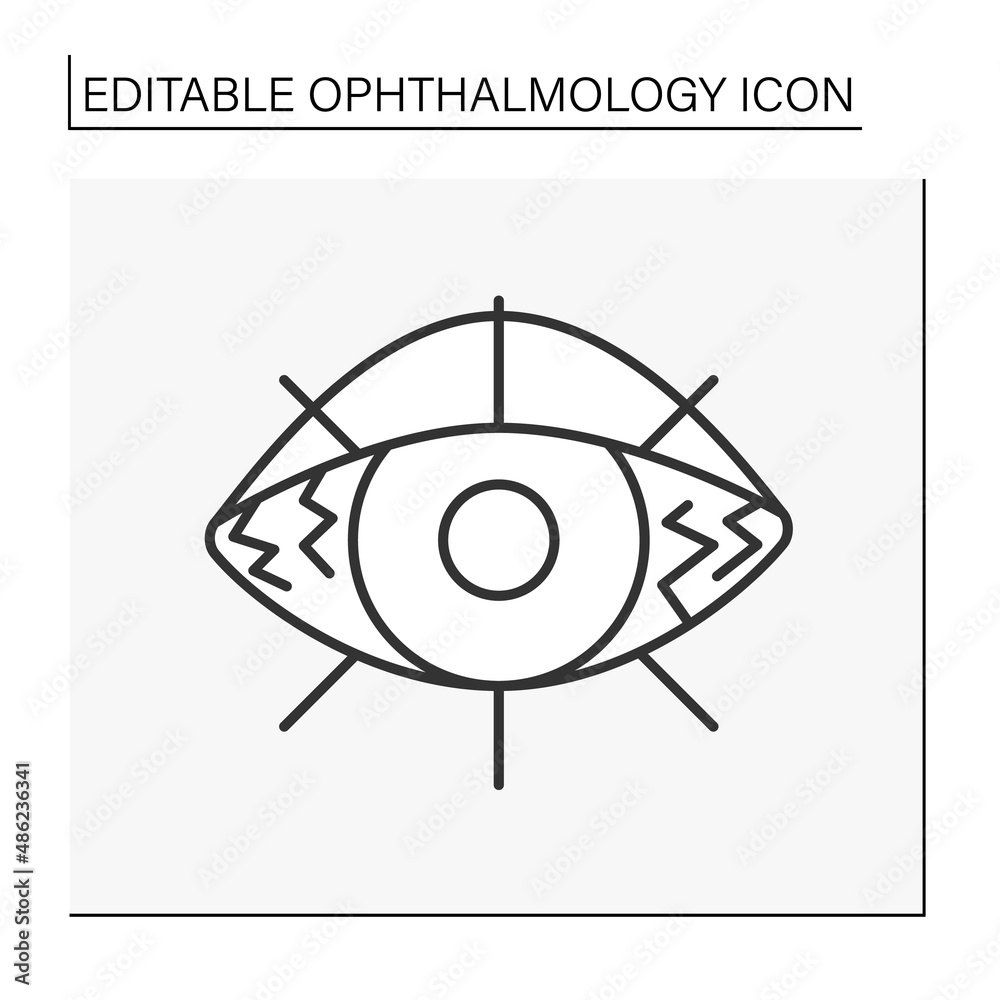 Disease line icon. Dry eye syndrome. Corneal or conjunctival dryness ...
