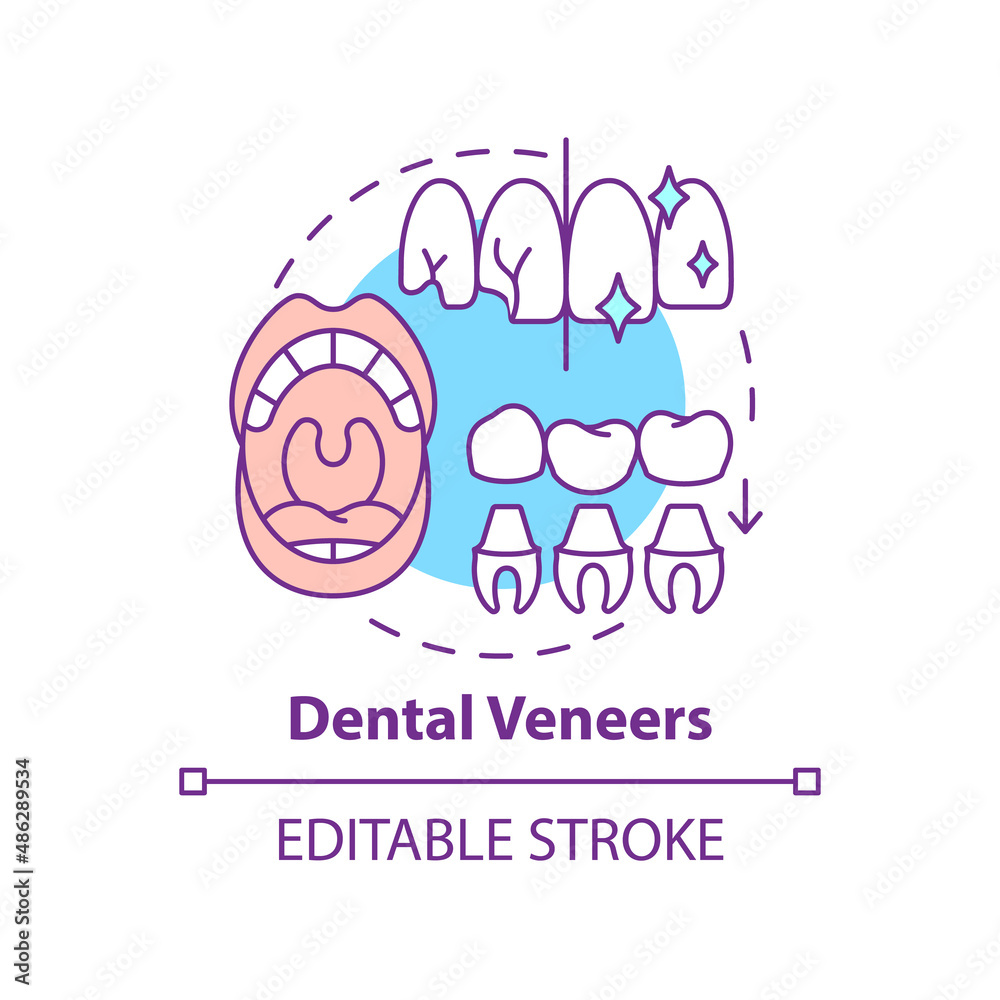 Dental veneers concept icon. Aesthetic dentistry type abstract idea ...