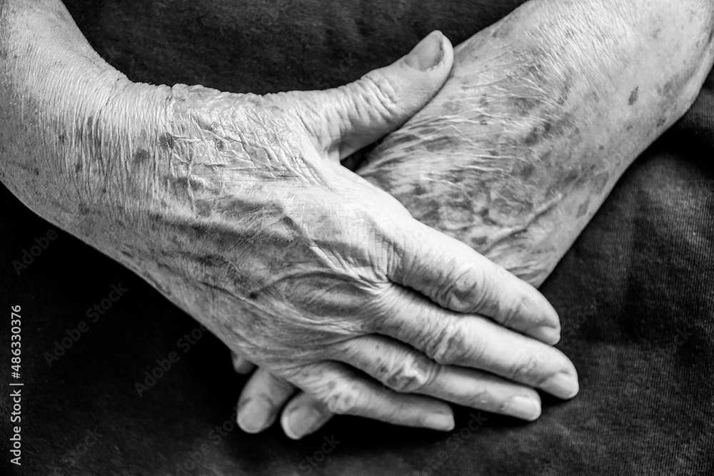 Hands of the old person. Close up of wrinkled hands of old woman with ...
