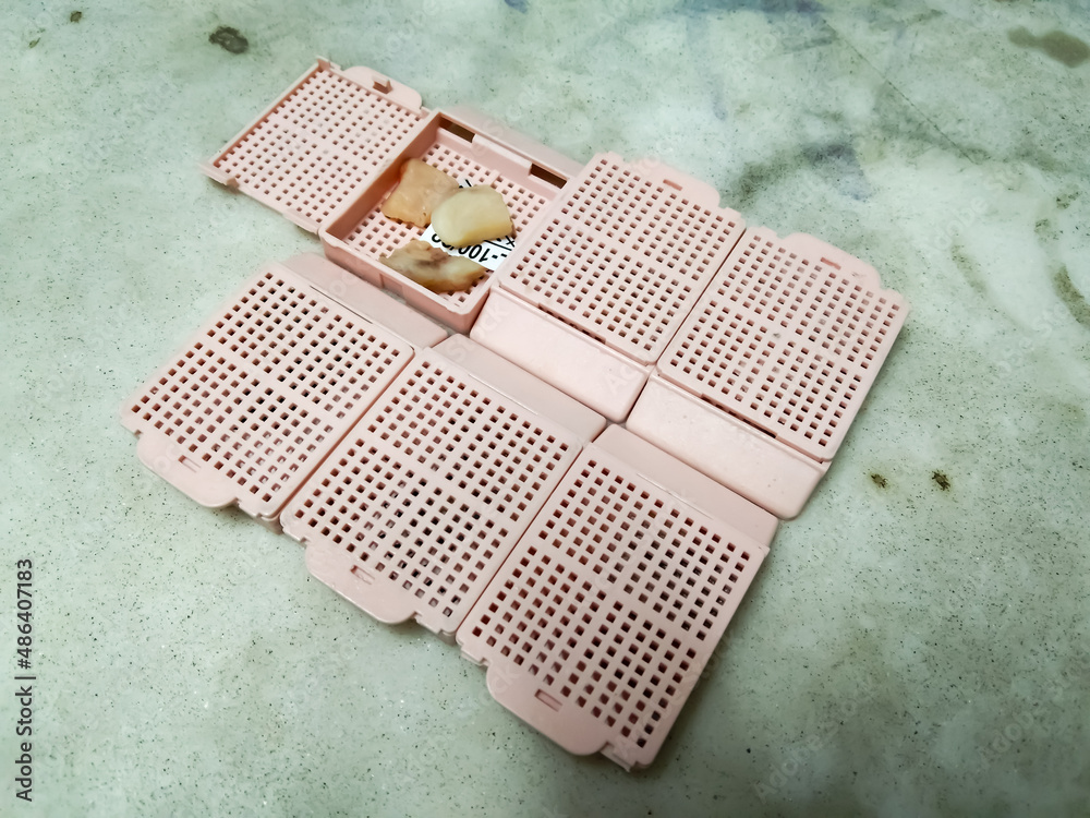 Histology tissue processing embedding cassettes during the specimen ...