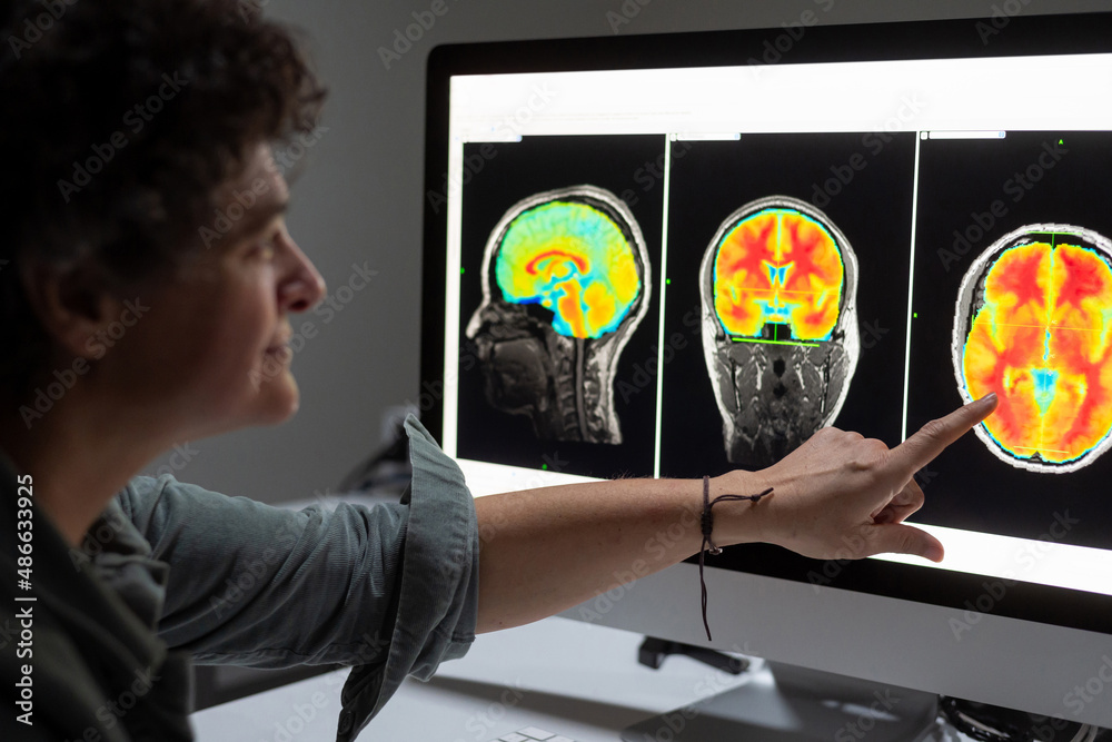 Female analyzing brain scan on computer Stock Photo | Adobe Stock