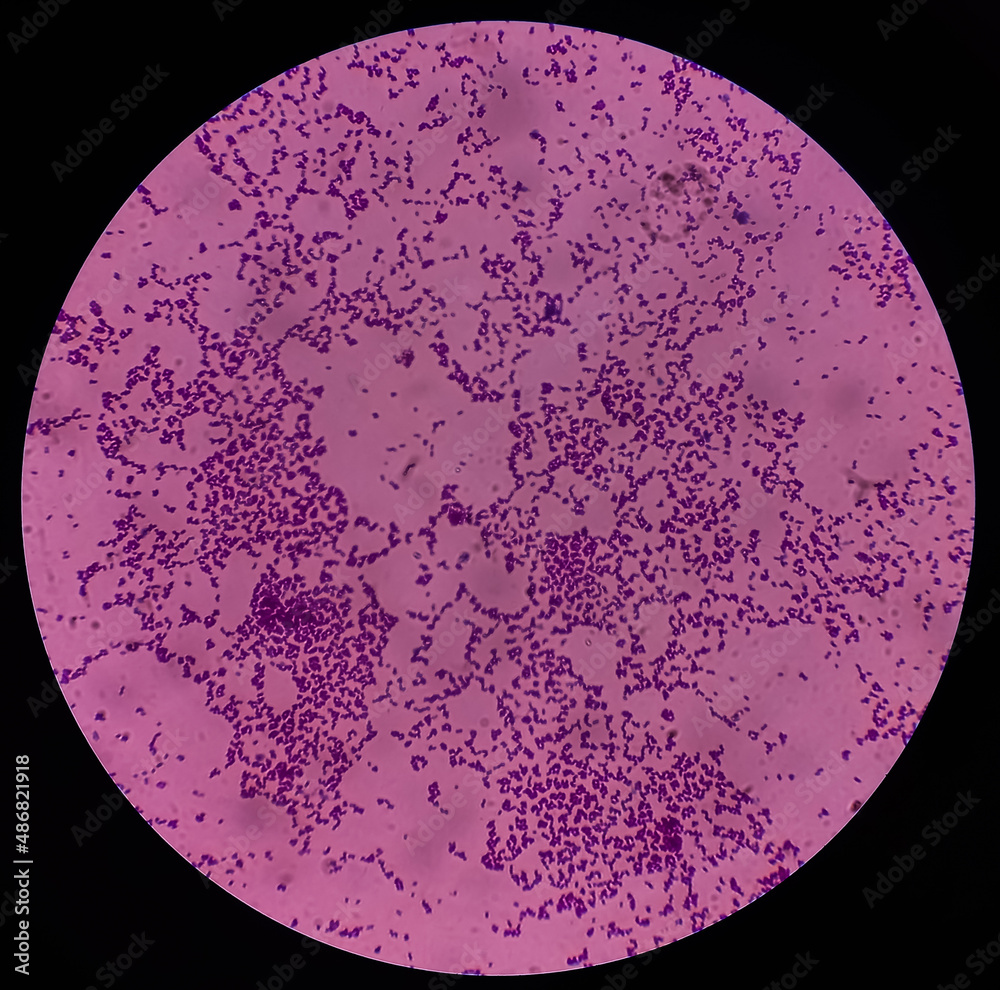 Microscopic view of Enterococcus bacteria from UTI patient urine sample ...