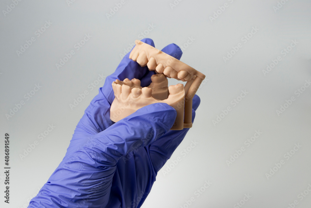 Gloved hand holding a dental bridge of upper and lower jaws printed on ...