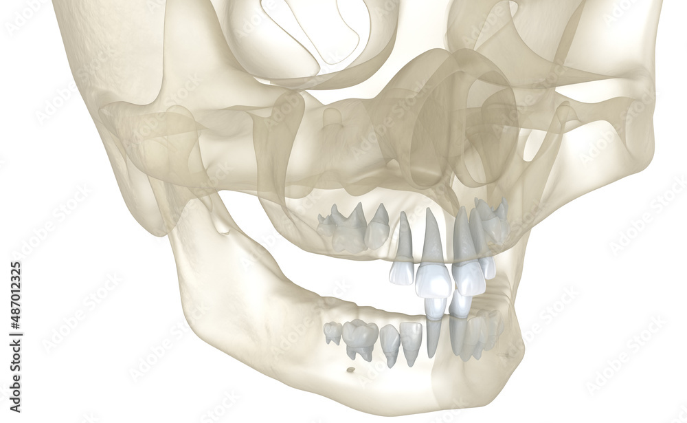 Baby primary tooth eruption. Medically accurate dental 3D illustration ...