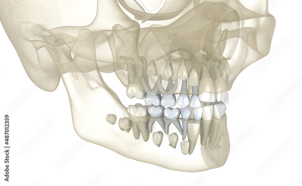 Permanent tooth eruption, losing primary teeth. Medically accurate ...
