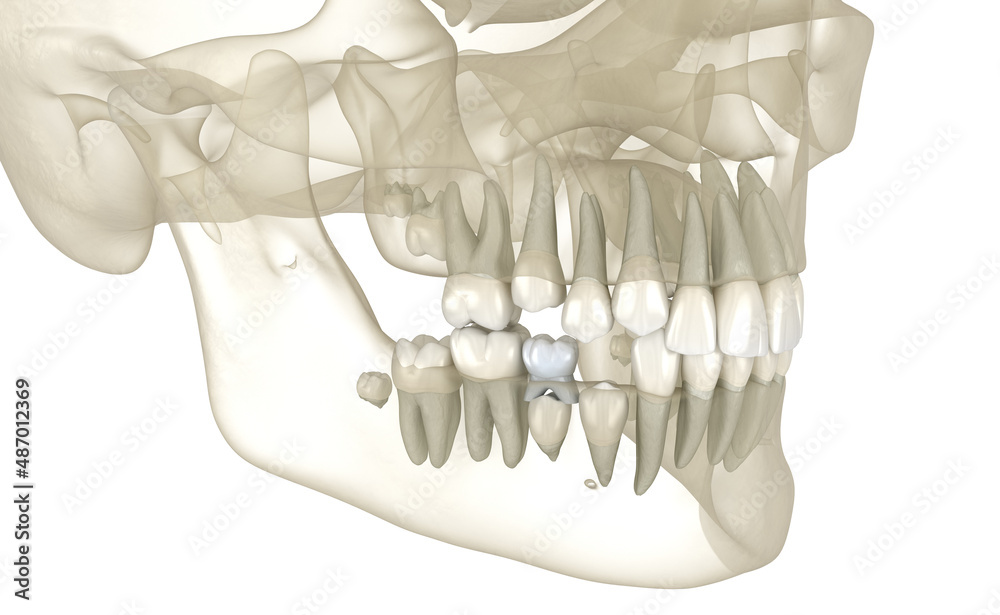 Permanent tooth eruption, losing primary teeth. Medically accurate ...