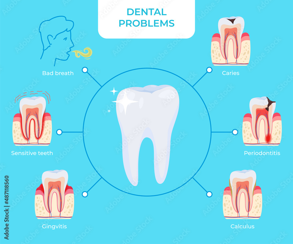 Dental problems circled scheme medical educational poster with ...