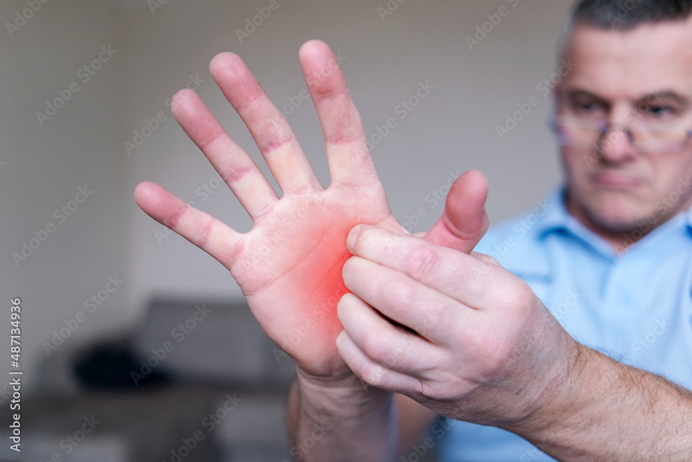 The concept of dermatitis, eczema, allergies, psoriasis. A man ...