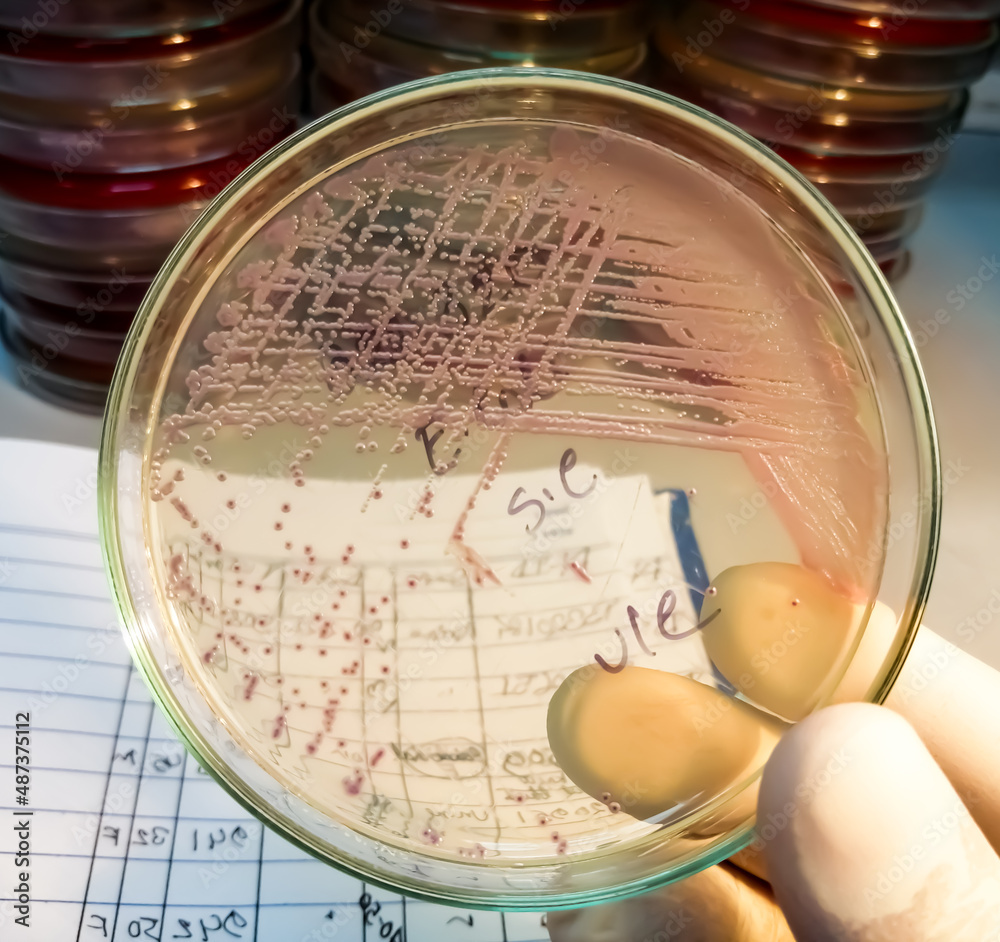 Pink colony of Escherichia coli (E. coli) on MacConkey medium in ...