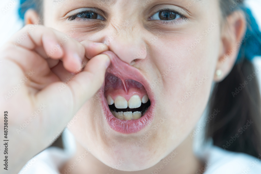 little girl showing her healthy teeth at dental office, smiling and ...