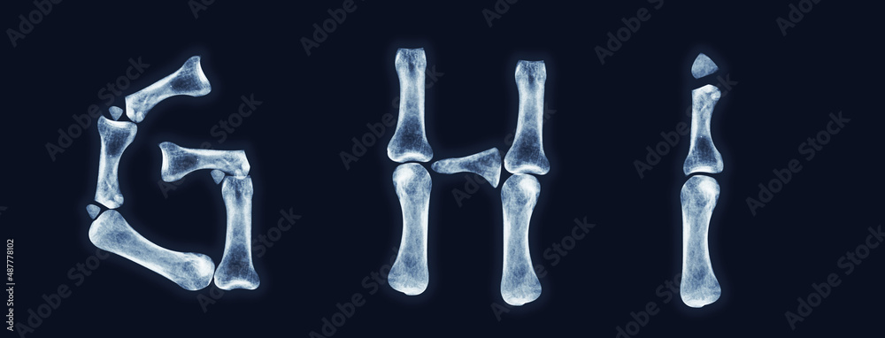 X-ray alphabet. Bone letters G, H, I. Realistic illustration. Black ...