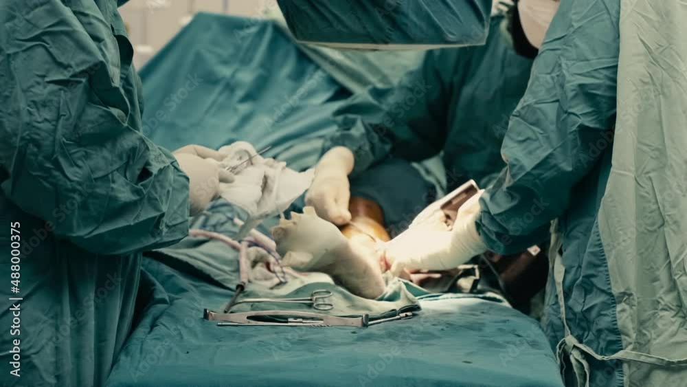 4k Slow motion, Assistant preparing instruments support Orthopedic ...