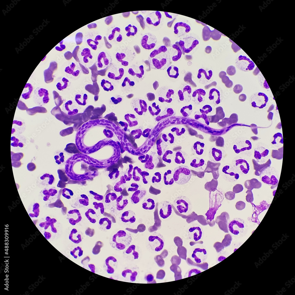 Microfilariae are not sheathed in the blood smear of a dog. Light ...