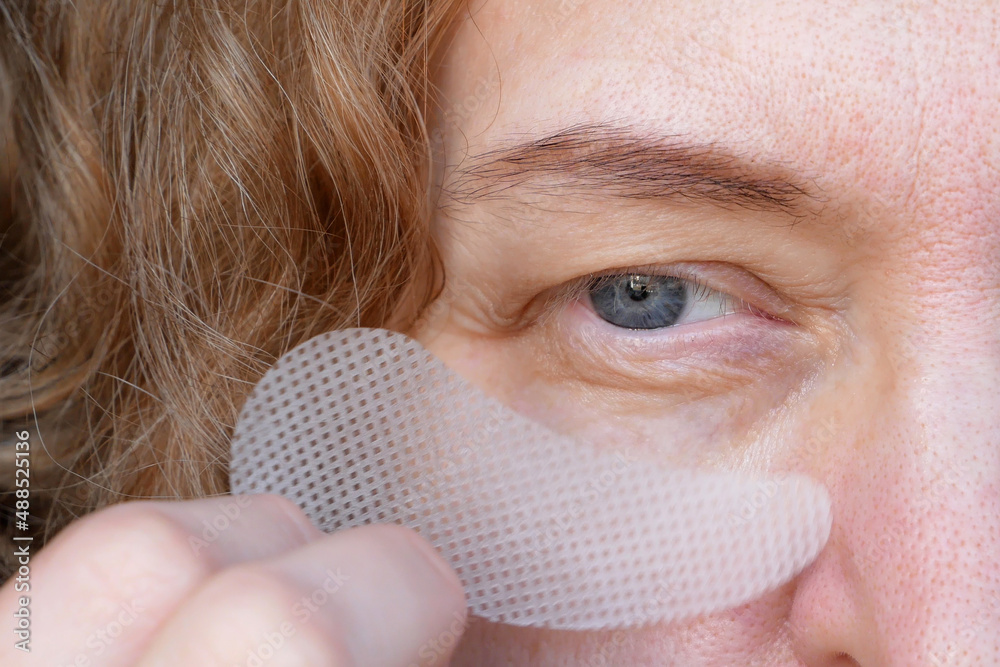 middle aged female's eye with drooping eyelid with patch for eyes ...