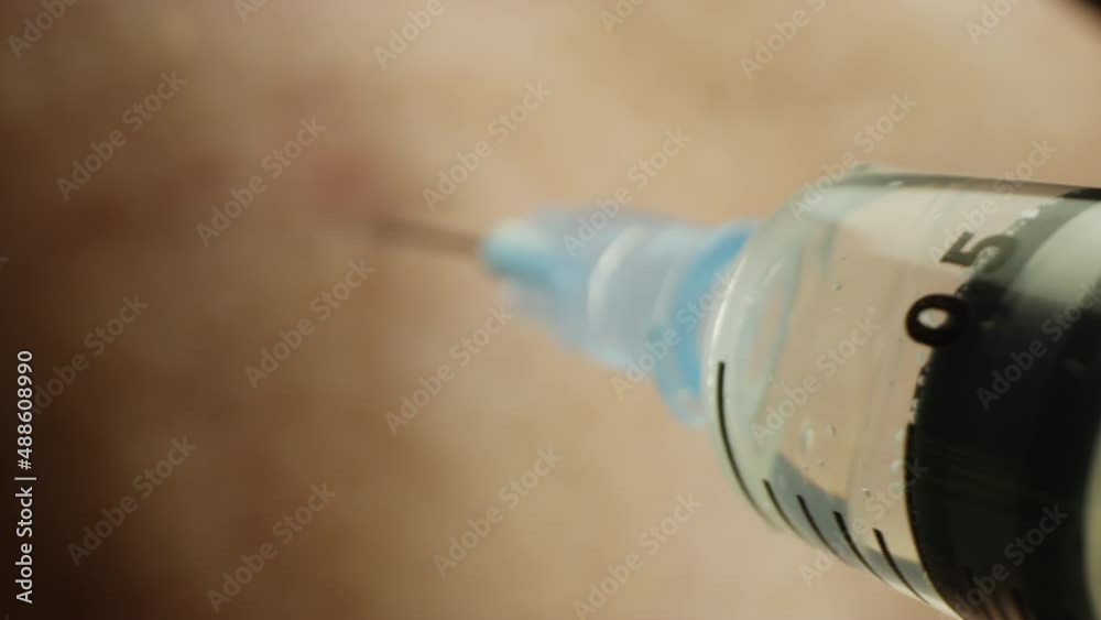 All stages of the operation for the introduction of intramuscular ...
