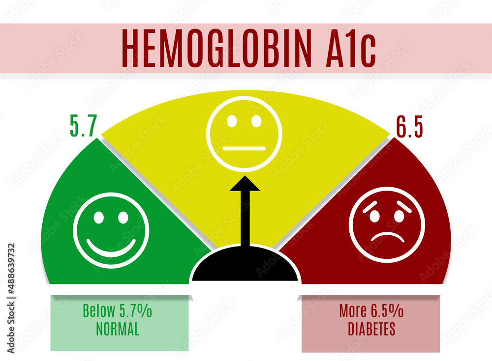 illustration of Hemoglobin A1c test score on white background. Stock ...
