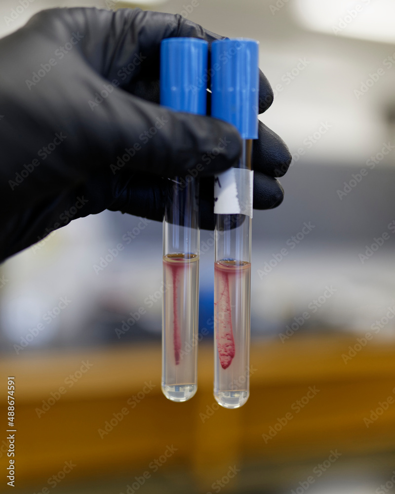 Motility test media showing good and bad stab lines. Visible color ...