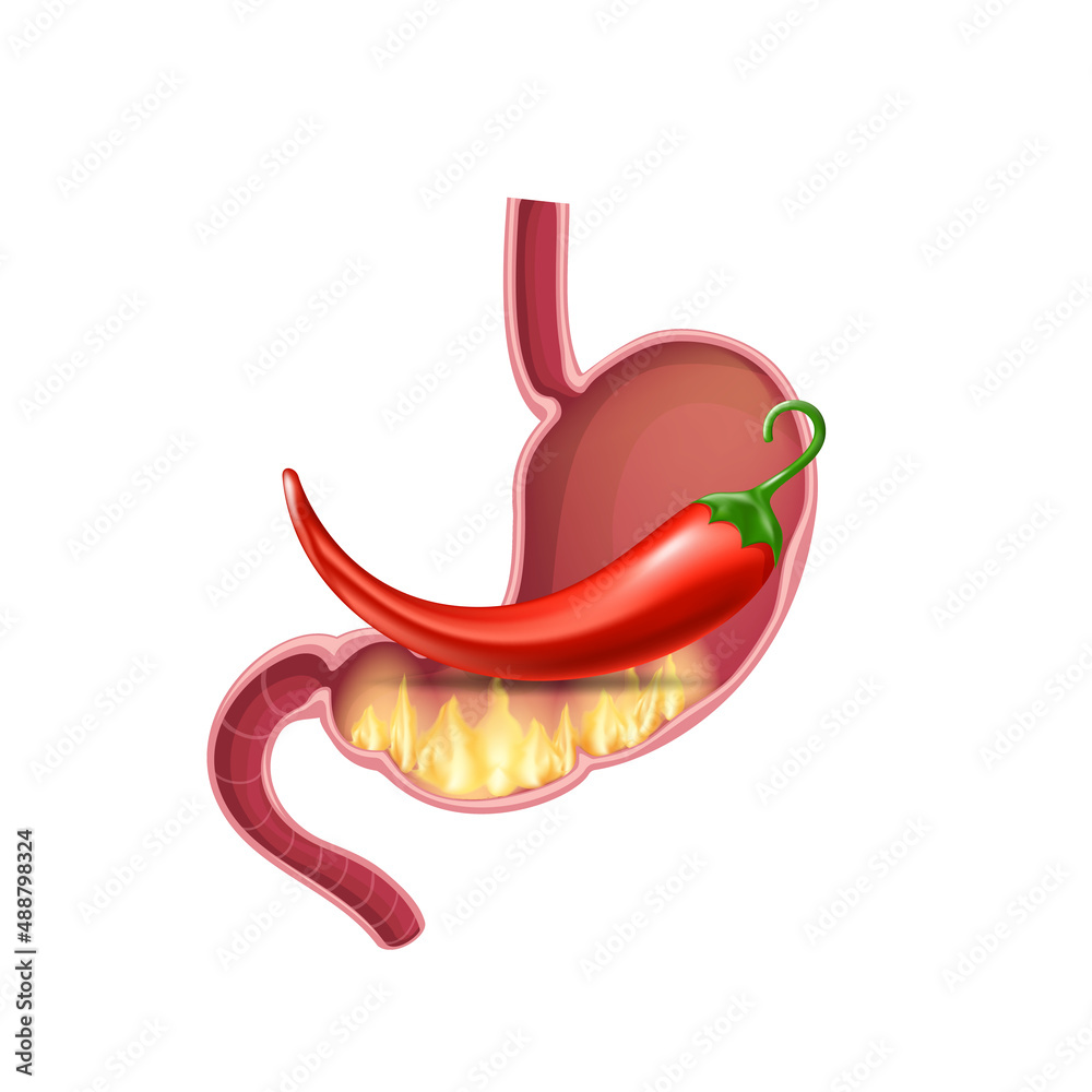 Stomach with red pepper fire, gas and gastric acid. Healthy food ...