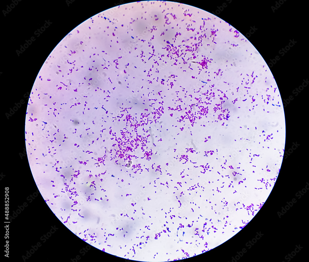 Escherichia coli bacterium, E.coli, gram-negative rod-shaped bacteria ...
