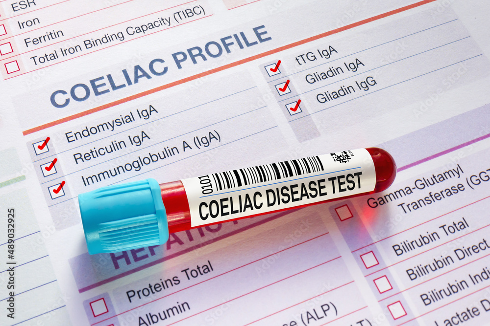 Blood sample tube for analysis of Coeliac and gluten disease test in ...
