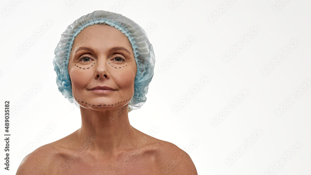 Foto de Middle aged woman with puncture lines on her face do Stock ...