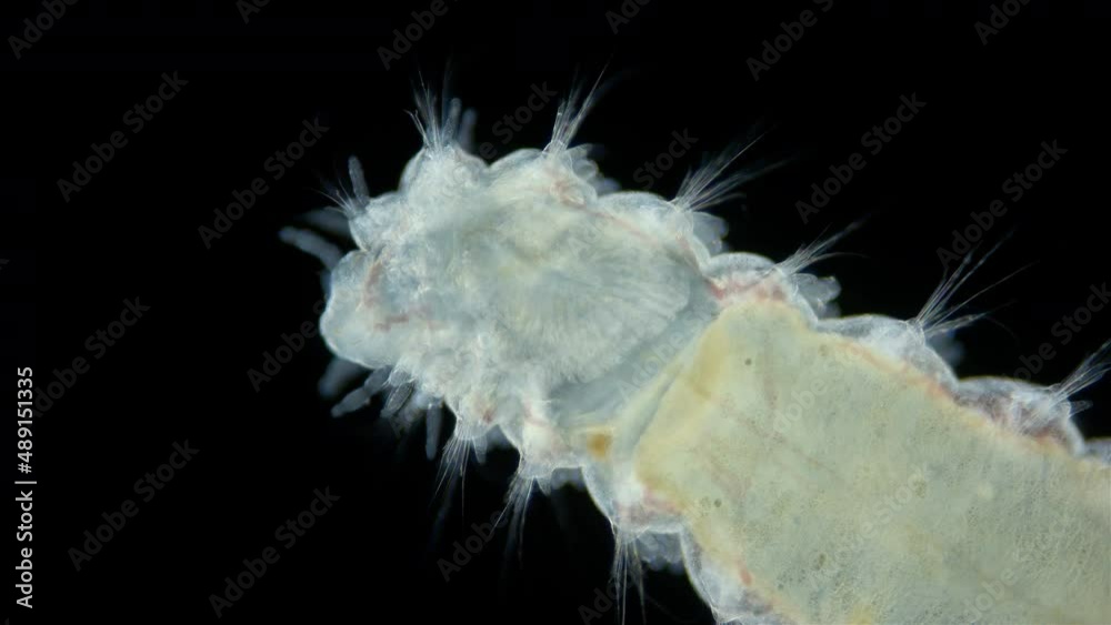 Worm Polychaeta family Amphinomidae under a microscope. Possibly Genus ...