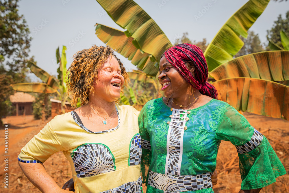 Two African friends look at each other and laugh, an albino girl with ...