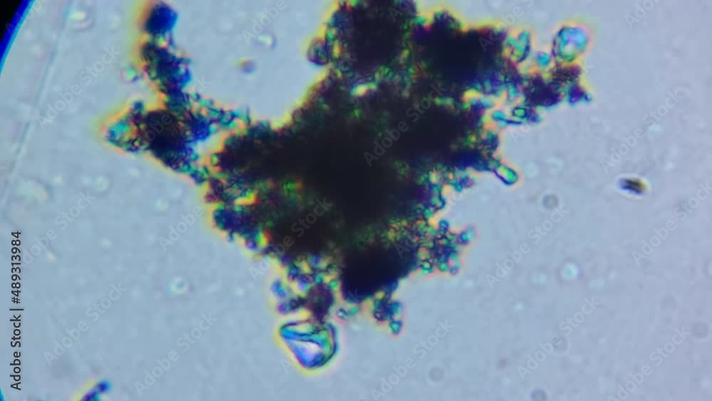 Vidéo Stock Microscopic bacterial virus organism floating around ...