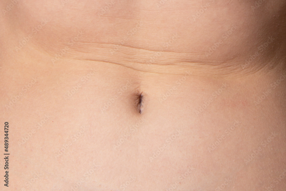 Woman belly with folds. Parts of a female body. Perfect body shape ...