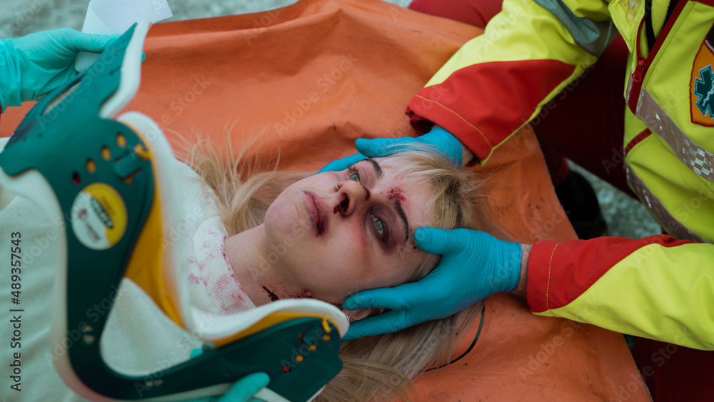 Caucasian Female Face Covered in Blood Stains and Bruises Unconscious ...