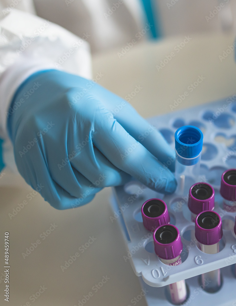 Process of coronavirus PCR antigen testing examination by nurse medic ...