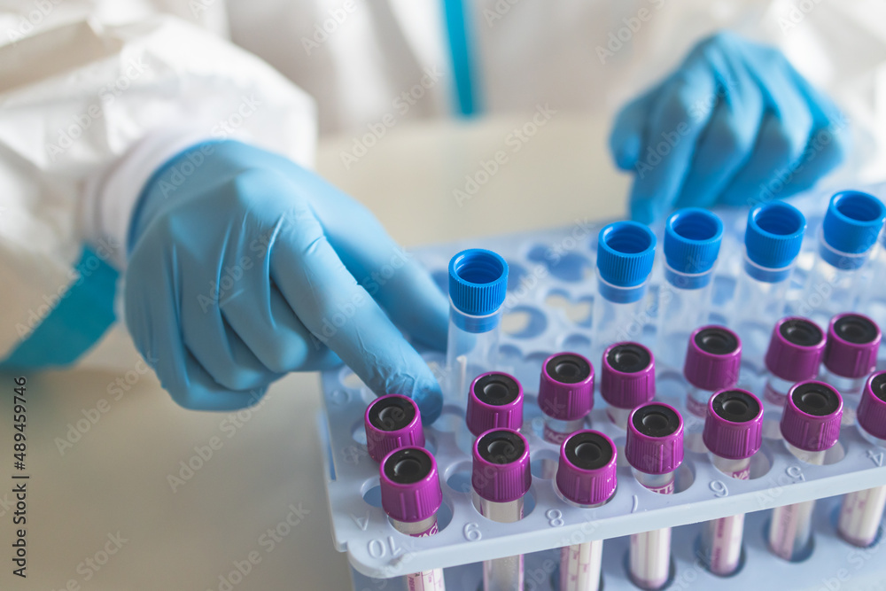Process of coronavirus PCR antigen testing examination by nurse medic ...