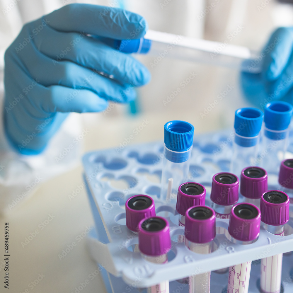 Process of coronavirus PCR antigen testing examination by nurse medic ...