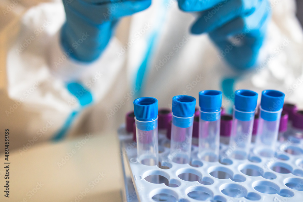 Process of coronavirus PCR antigen testing examination by nurse medic ...